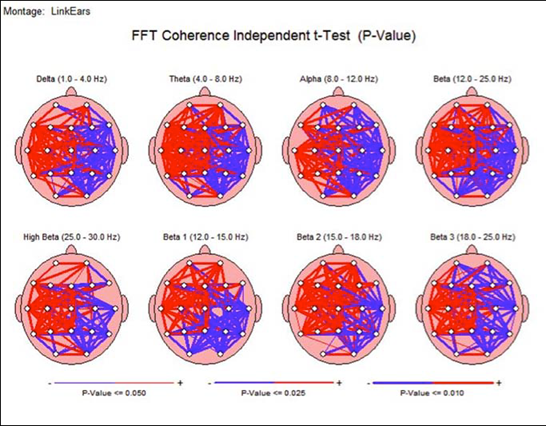 How does Psych-k work? A Whole-Brain state is created around a belief